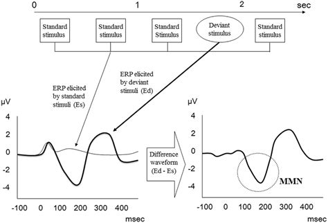 Frontiers Mismatch Negativity As A Translatable” Brain Marker Toward Early Intervention For