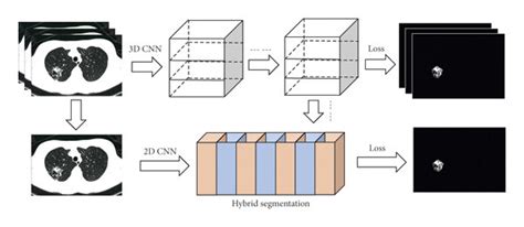 The Basic Structure Of The Hybrid Segmentation Network Download Scientific Diagram