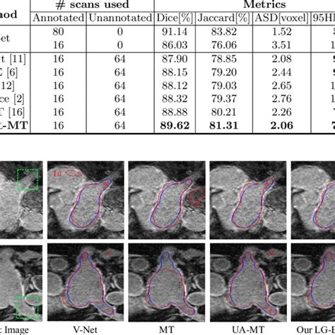 Comparison Results Of Different Segmentation Methods Download Scientific Diagram