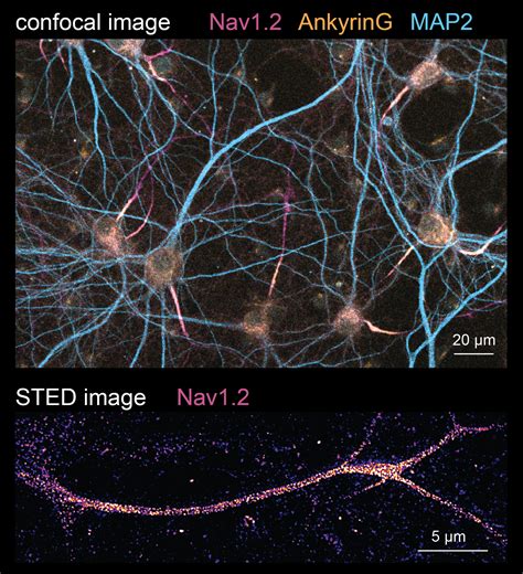Axon Initial Segment Biology Cncr
