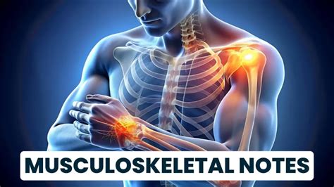 Usmle Step 2 Ck High Yield Musculoskeletal Topics The Match Guy