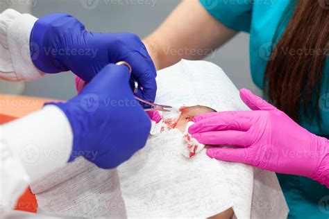 Doctor Suturing A Patient During A Small Surgery Dermatologist Carrying Out A Removal Of Benign