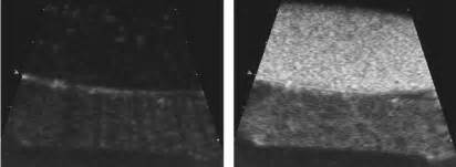 Visualization Of Imaging Artefacts Due To Nonlinear Propagation With A Download Scientific