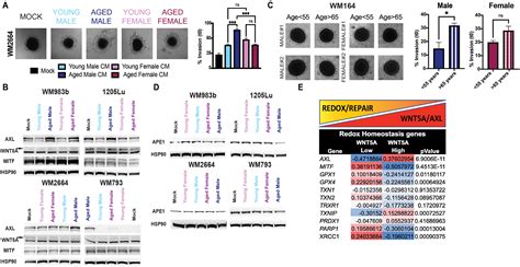 Sex Dependent Effects In The Aged Melanoma Tumor Microenvironment Influence Invasion And