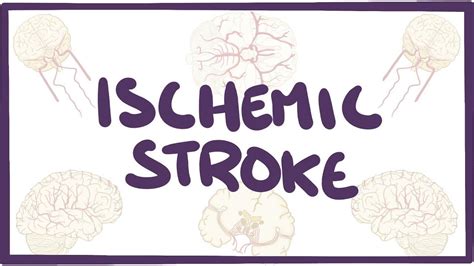 Ischemic Stroke Causes Symptoms Diagnosis Treatment Pathology Artofit