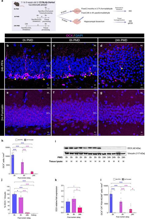 Impact Of The Post Mortem Delay PMD And Fixation Time On The Download Scientific Diagram