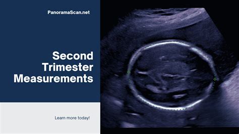 Fetal Biometry Course