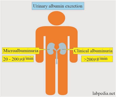 Diabetes Mellitus Part 8 Diagnostic Criteria Management And