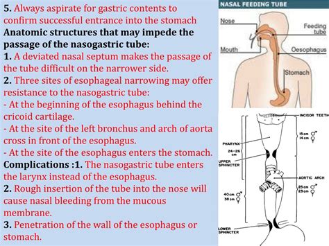 Ppt Comprehensive Guide Peritoneal Lavage Anatomy And Complications