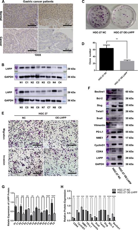 The Biological Functions Of The Lhpp Gene Were Determined In Gastric Download Scientific