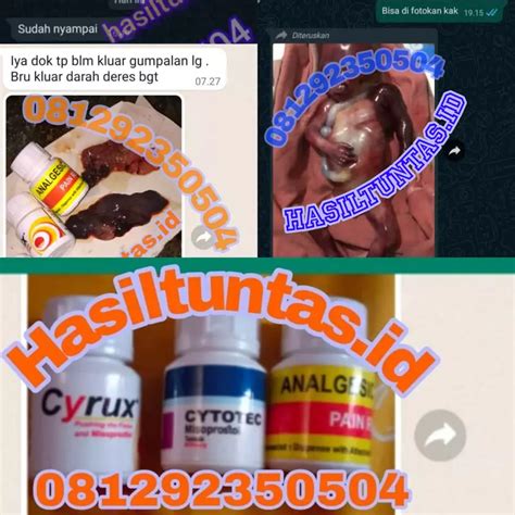 Perbedaan Obat Cytotec Asli Dan Palsu 081292 3 50504 Users Rciims
