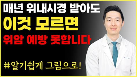 장상피화생위암 위내시경 검사 받기 전에 이것부터 아셔야 합니다 Youtube