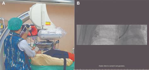 Afb Dye Marking A The Bronchoscopic Procedure Was Guided By C Arm Download Scientific Diagram