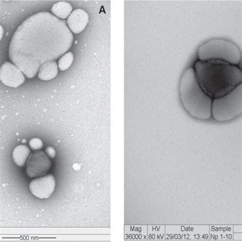 Electron Micrograph Of Polycaprolactone Nanoparticles Nps Differ In Download Scientific