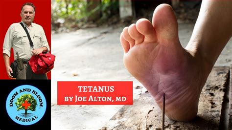 Tetanus Prevention Symptoms Treatment And More YouTube