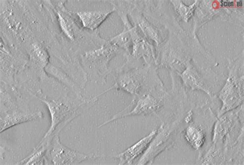 Human Choroid Plexus Fibroblasts Hcpf
