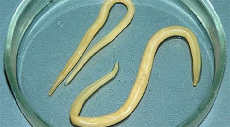 Аскаридоз симптомы и схема лечения у взрослых