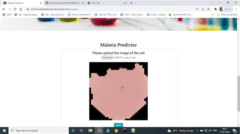 github sanjana520 malaria predection online malaria predictor