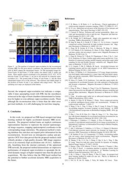 Spatiotemporal Implicit Neural Representation For Unsupervised Dynamic MRI Reconstruction DeepAI