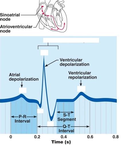 Ecg Diagram Quizlet