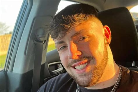 Man S Head Swells Like A Balloon As He Ignores No Sex Rule After Turkey Hair Transplant