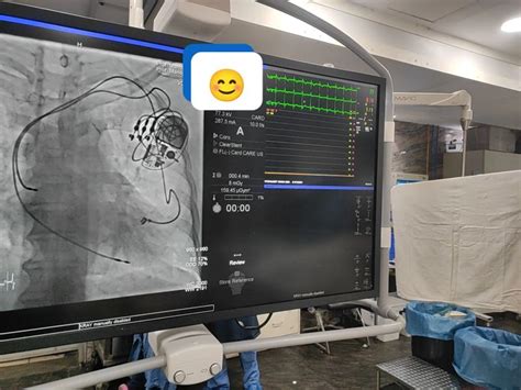 Kaleem Azhar On Linkedin It Is A Really Hard Decision For An Ivc Or Cardiac Electrophysiologist To…