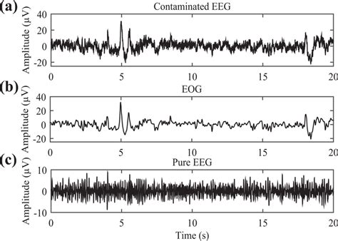 Separation Of Eog Artifact From Real Recorded Eeg Signal Using Download Scientific Diagram