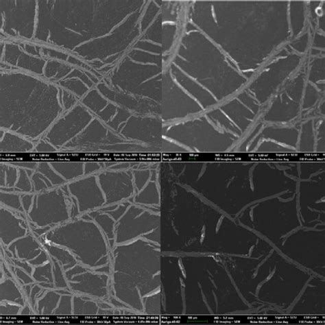 Types Of Fracture Intersection Points A X Type Intersection Point