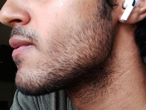 21 Year Old 1 Week Beard Growth Beard Board