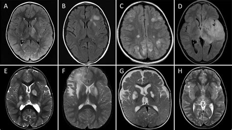 Differential Diagnosis Of Mogad Selected Examples Download