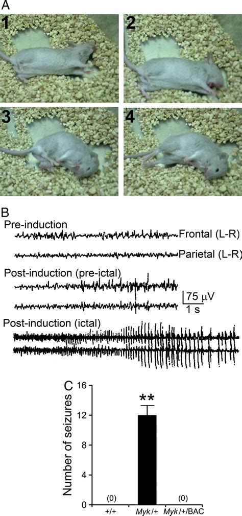 Epileptic Seizures In Myk Mice A Spontaneous Seizure In 16 Week