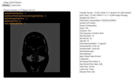 problem with displaying dicom · issue 429 · cornerstonejs cornerstone