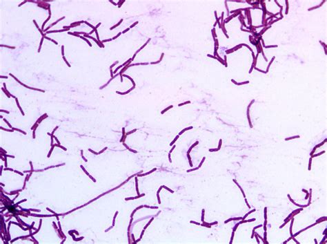 Bacillus Subtilis Morphology And Gram Stain