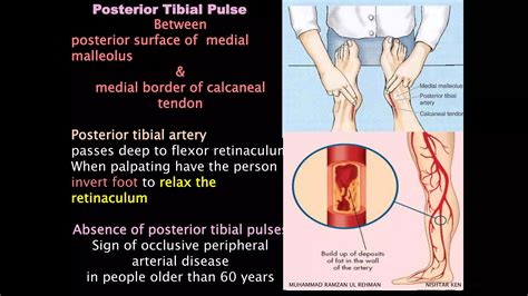 Clinical Anatomy Of The Lower Limb Pptx