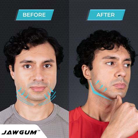Does Chewing Gum Helps Reduce Face Fat Cheap Sale Varsana