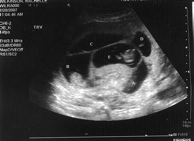 Acc Statistics Professor Raising Quintuplets 2 Acc Newsroom