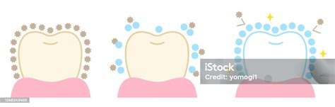 폴리 포스포릭 산 치아 미백 귀여운 만화 일러스트 치과 진료 개념 치아 미백에 대한 스톡 벡터 아트 및 기타 이미지 치아 미백 일러스트레이션 산성 Istock