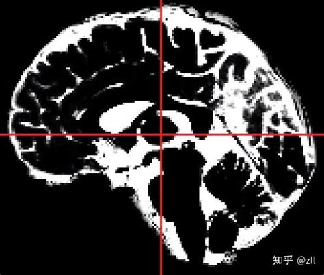 Part Spm Fmri