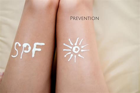 What Are The Signs And Symptoms Of Melasma Vs Hyperpigmentation