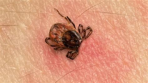 Australian Tick Identification Chart