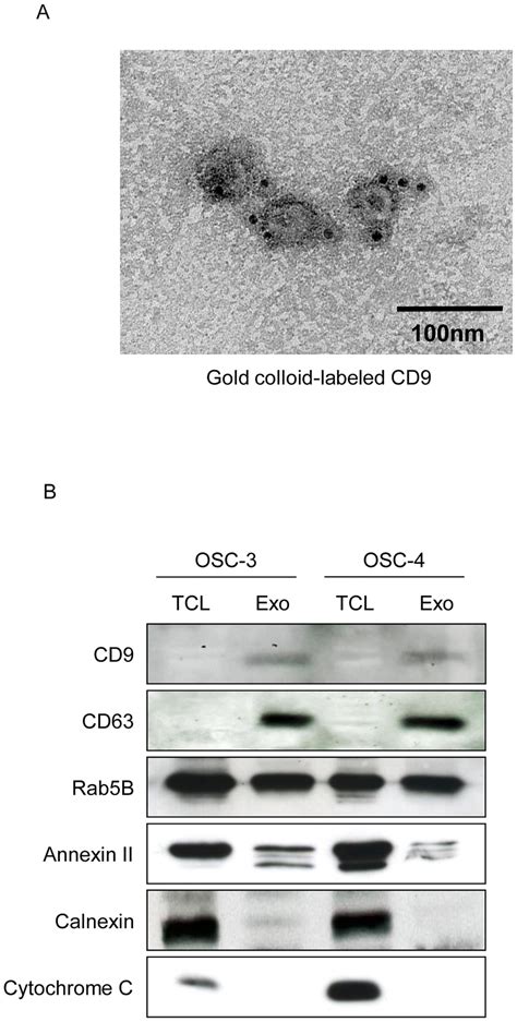 Characterization Of Oscc Cell Derived Exosomes A Immunolabeling Of