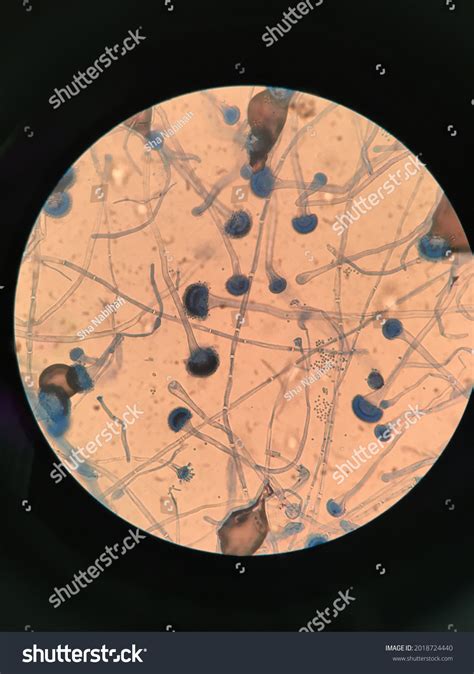 Aspergillus Under Microscope Shape