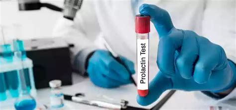 Prolactin Test A Complete Guide For Test Procedure Uses And Cost Ganesh Diagnostic