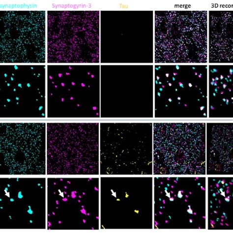 segmented array tomography images array tomography ribbons were