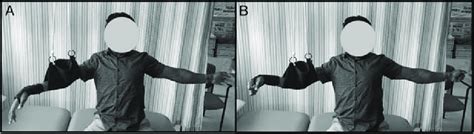 Selective Activation Or Donor Deactivation Exercises For Example