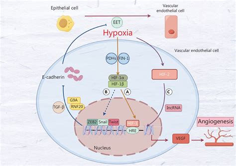 Research Progress In Tumor Angiogenesis And Drug Resistance In Breast