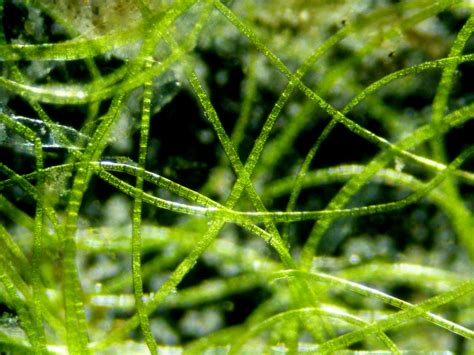 Just Some String Algae In Dark Field Along With