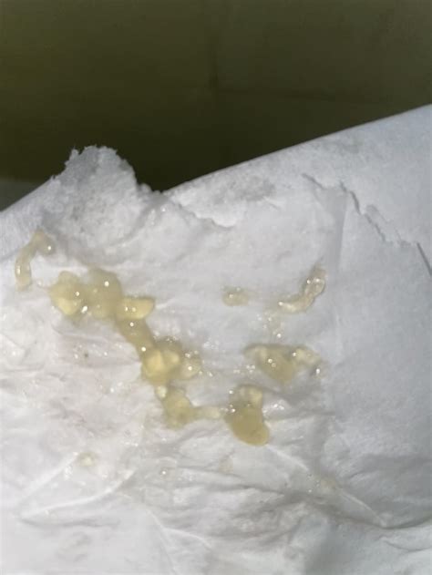 Why Is My Sperm Like Jelly R Hiv