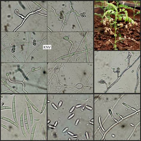 Dr Vijaykumar K N On Linkedin Fusariumwiltofchickpea Microconidia Macroconidia Dr Vijaykumar K N On Linkedin Fusariumwiltofchickpea Microconidia Macroconidia