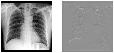 Convolutional Neural Network Convolutional Neural Network